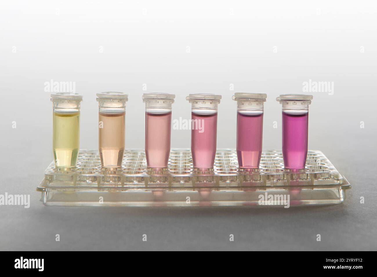 Plastic test tubes containing liquid samples are displayed on a rack ...