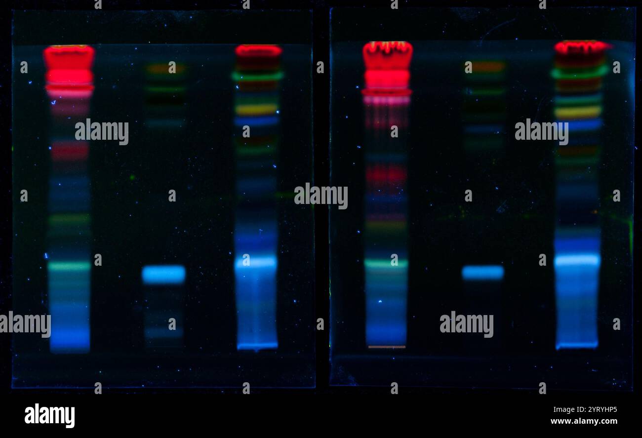 Electrophoresis gel separating proteins by size and charge, creating ...