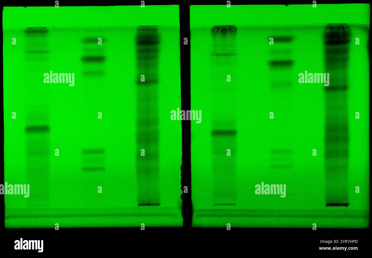 Protein electrophoresis revealing protein bands under uv illumination ...