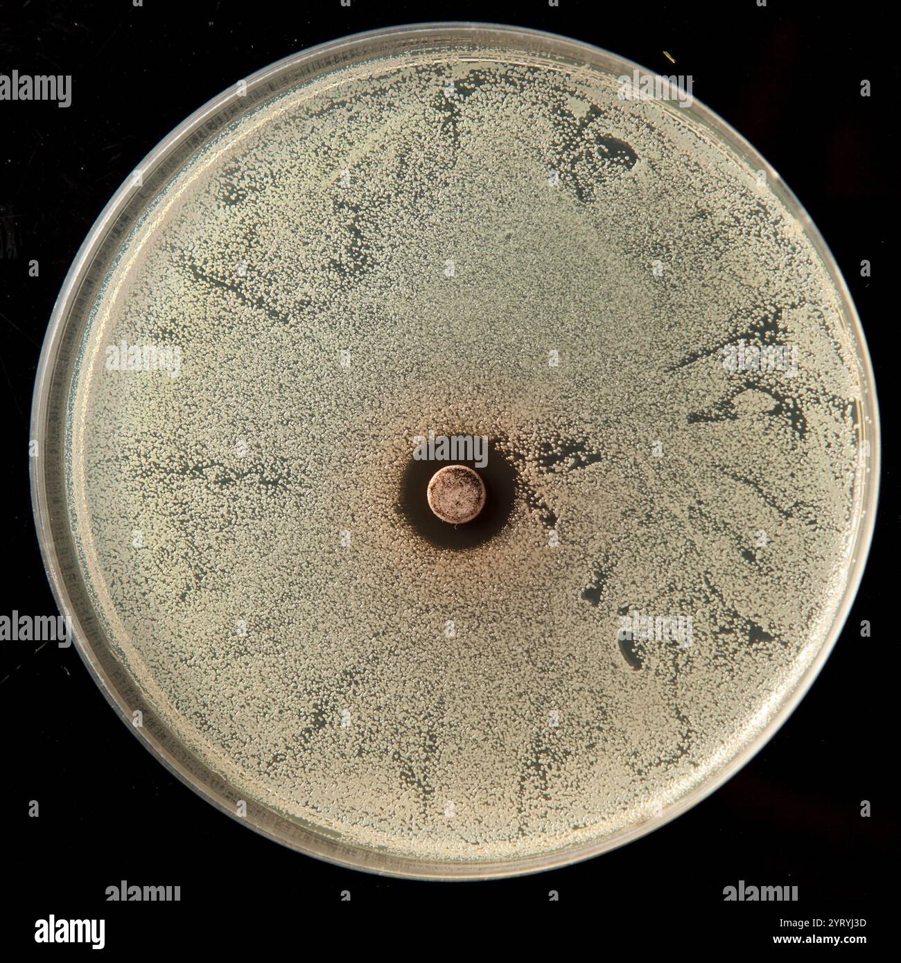 Close-up of a petri dish with antibiotic sensitivity test, revealing ...