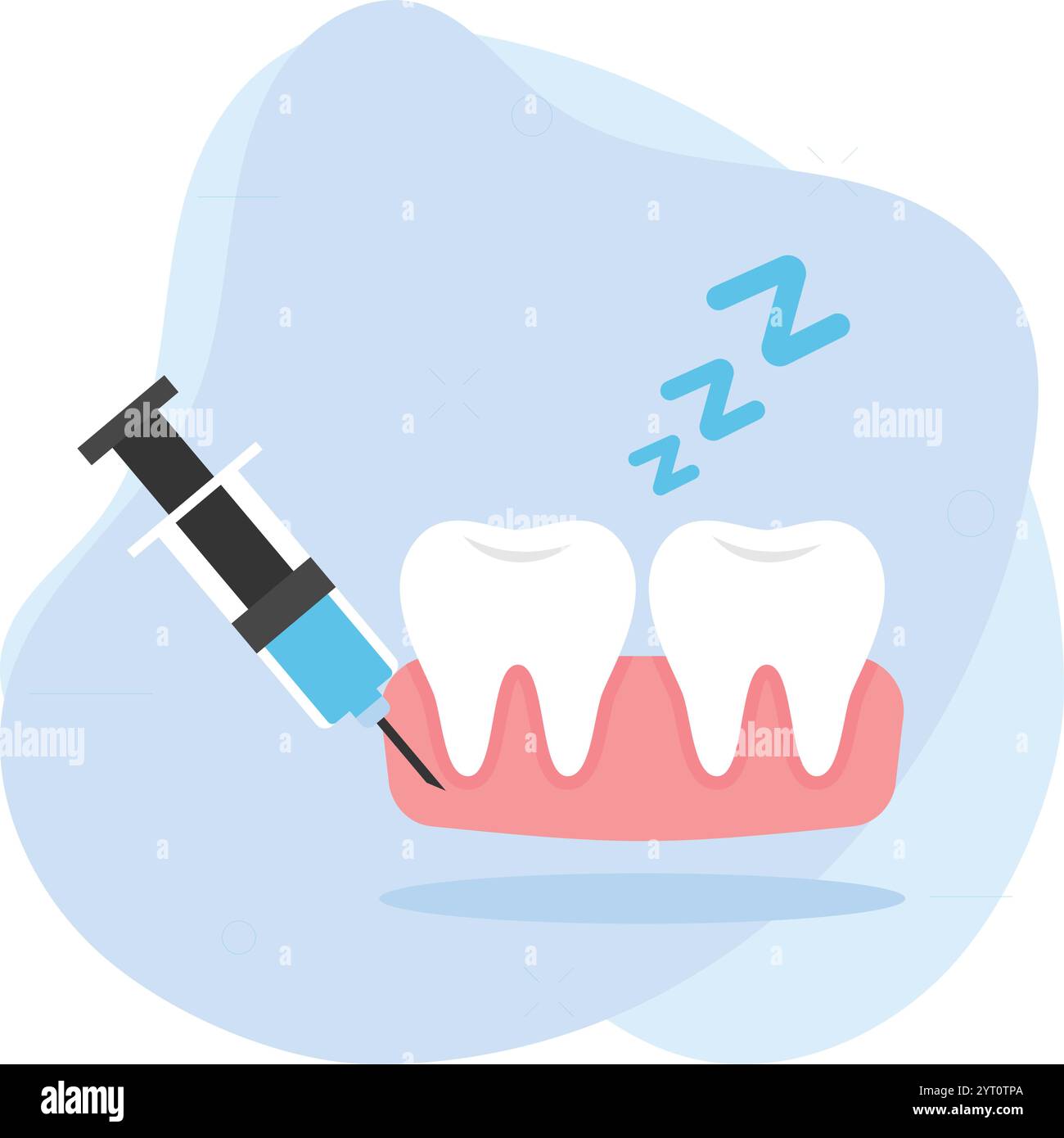 syringe for local anesthesia injection in gum for sedation concept ...