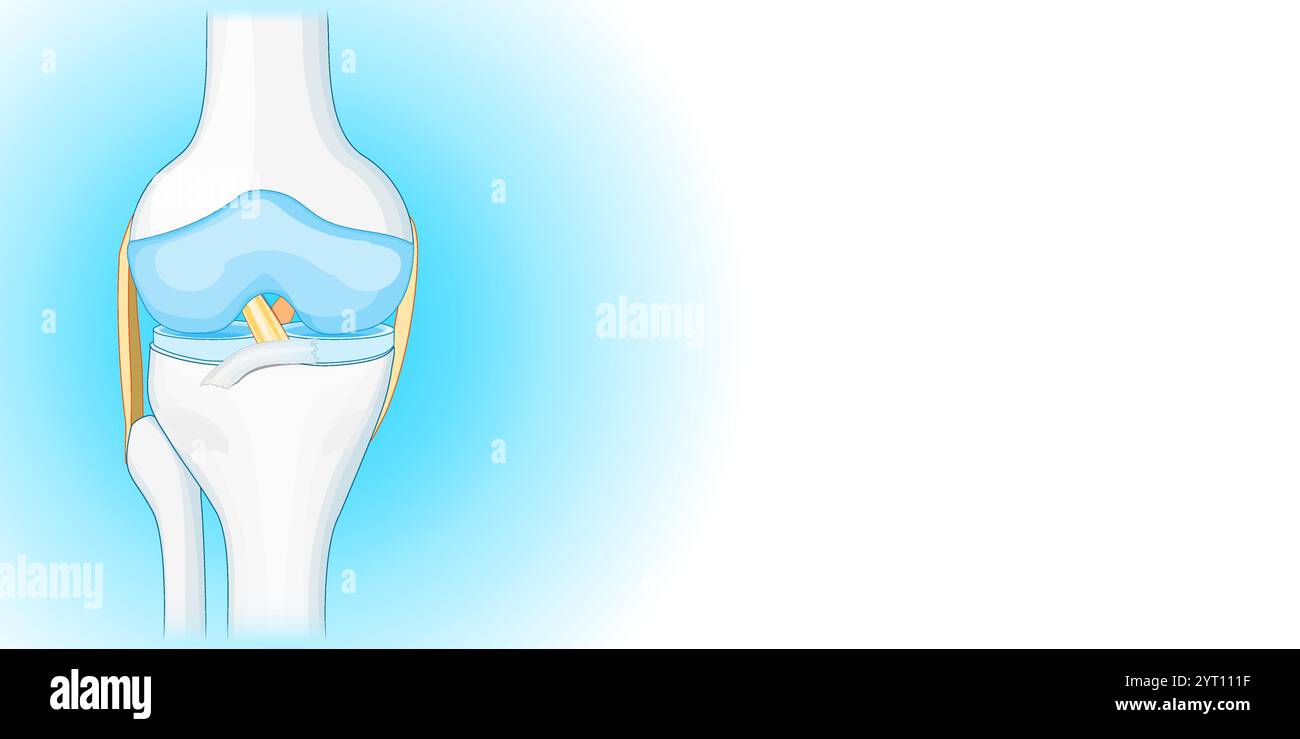 Bones of Knee joint on blue and white background with copy space for ...