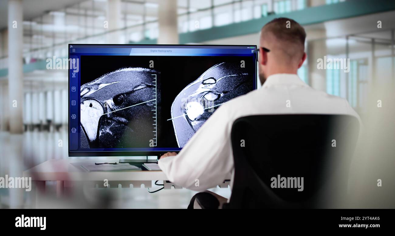 Doctor Screening Knee Bone X Ray On Computer Stock Photo - Alamy