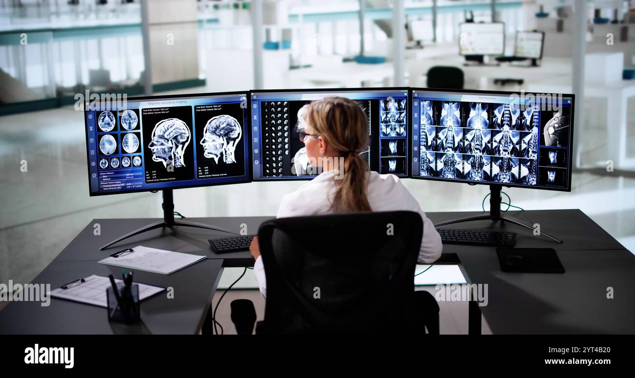 Mri scan brain young hi-res stock photography and images - Alamy