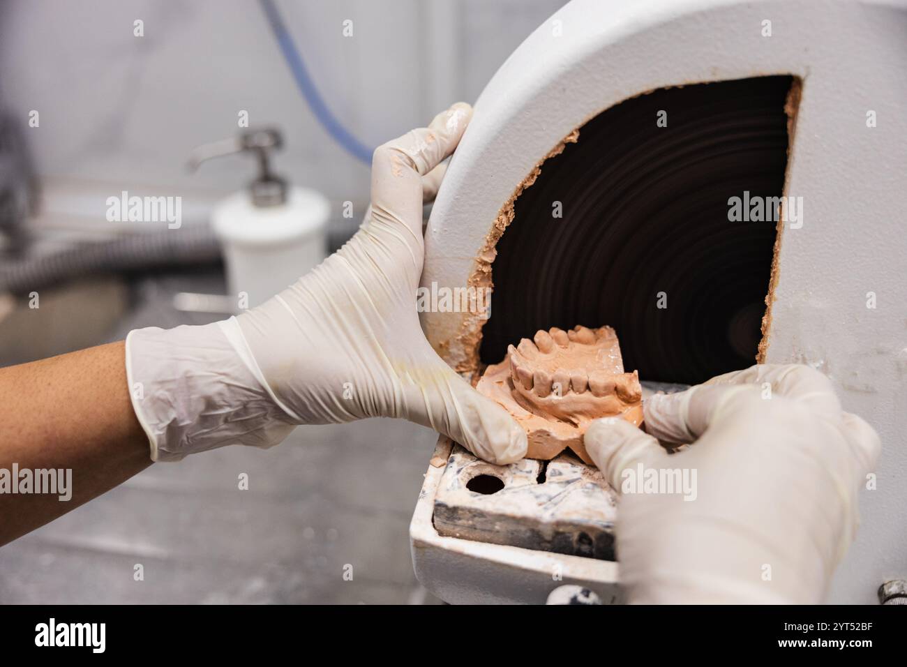 Detailed view of gloved hands working on a dental prosthetic mold in a ...
