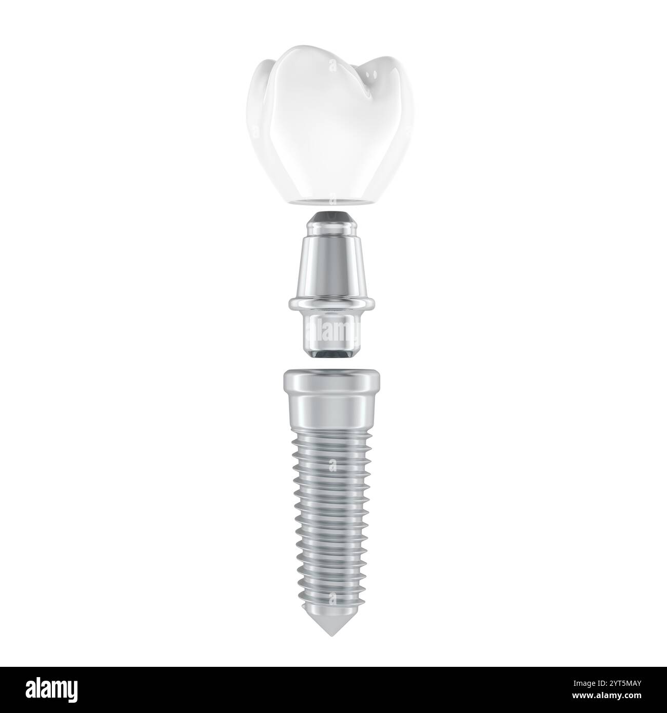 Dental implant. Screw, abutment and crown. 3D rendering isolated on ...
