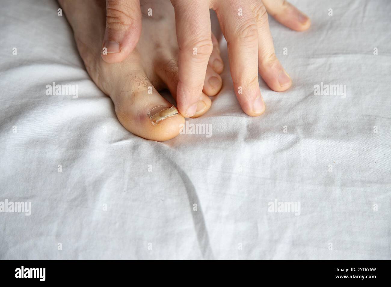 Medical self assessment hi-res stock photography and images - Alamy