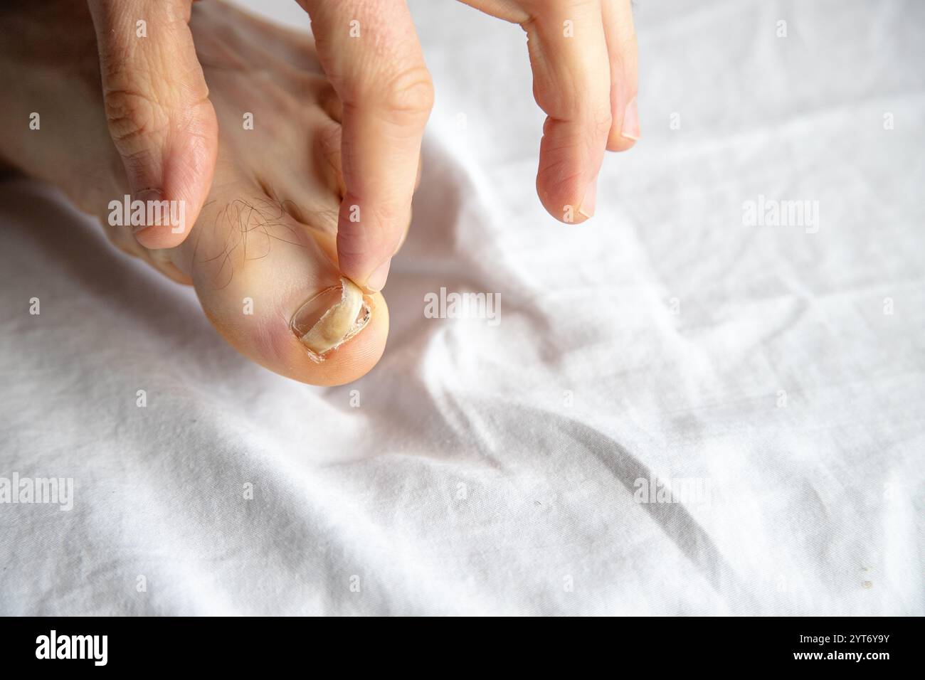 Treatment assessment hi-res stock photography and images - Alamy