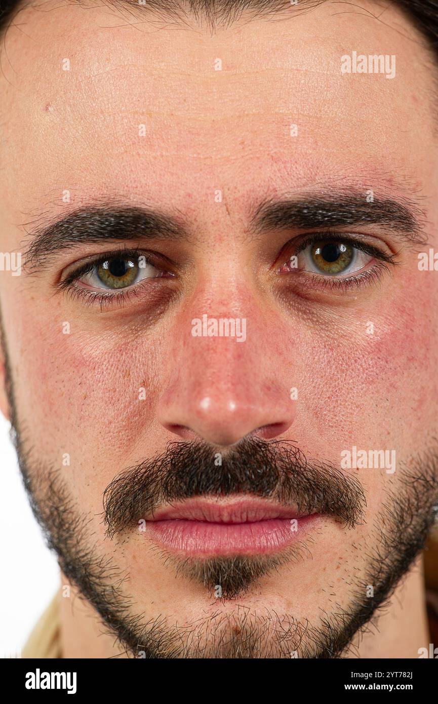 Allergic reaction face hi-res stock photography and images - Alamy