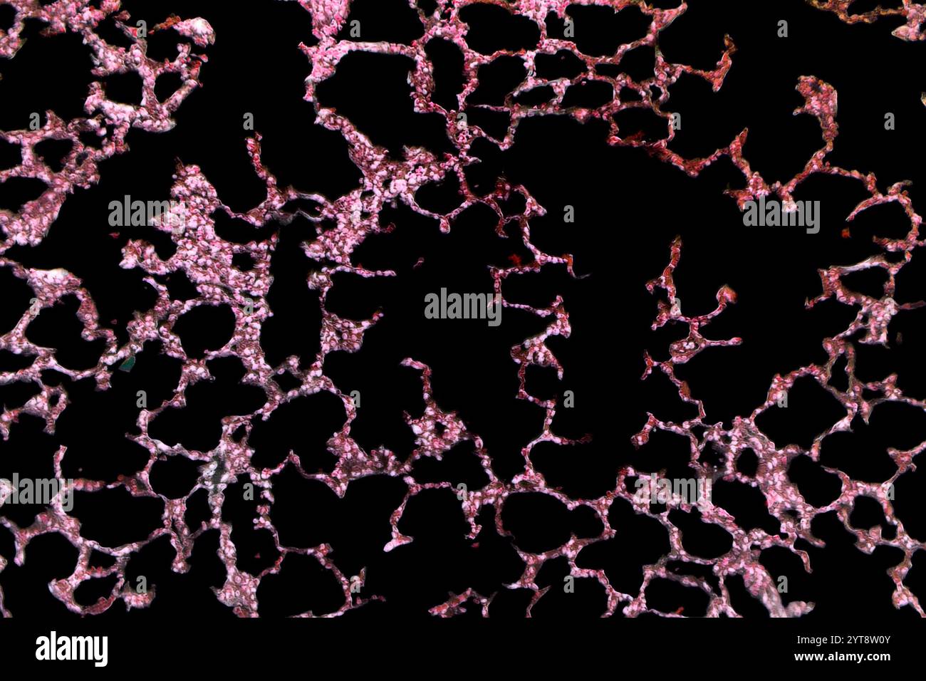 Microscopic detail showing a section of the lung tissue from a rabbit ...