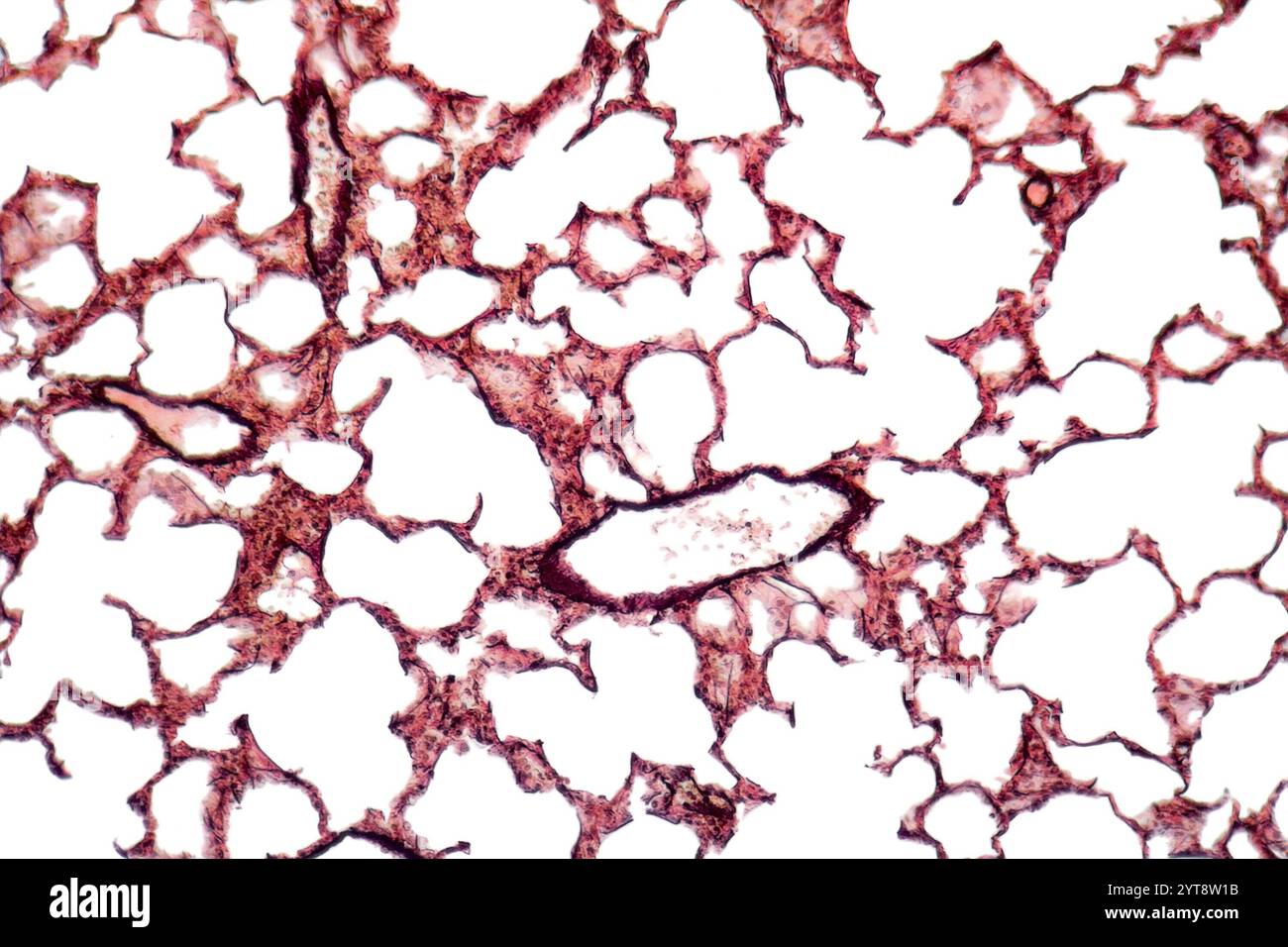 Microscopic detail showing a section of the lung tissue from a rabbit ...