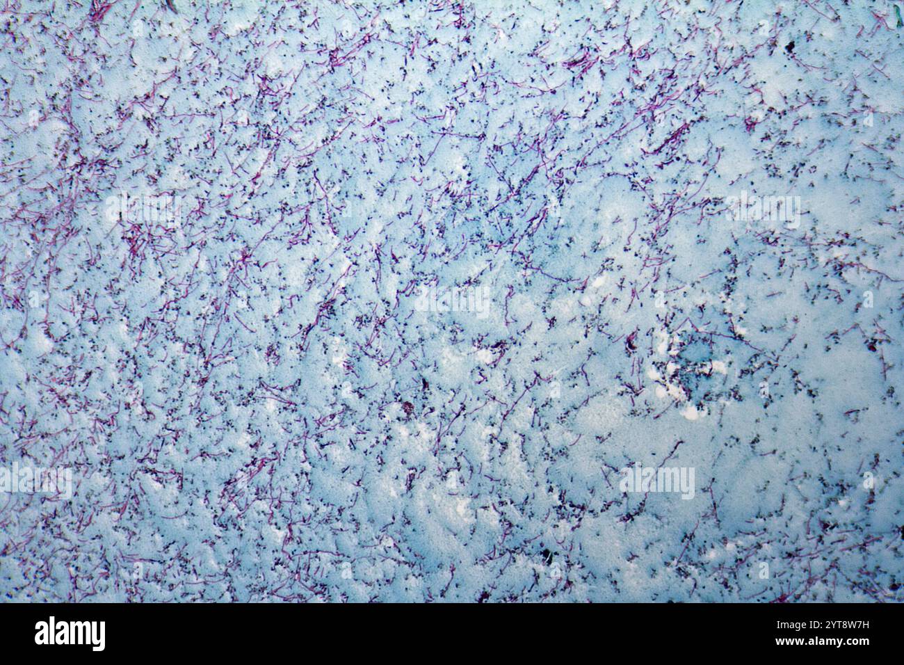 Micrograph showing a urinary bladder detail from a rat Stock Photo - Alamy