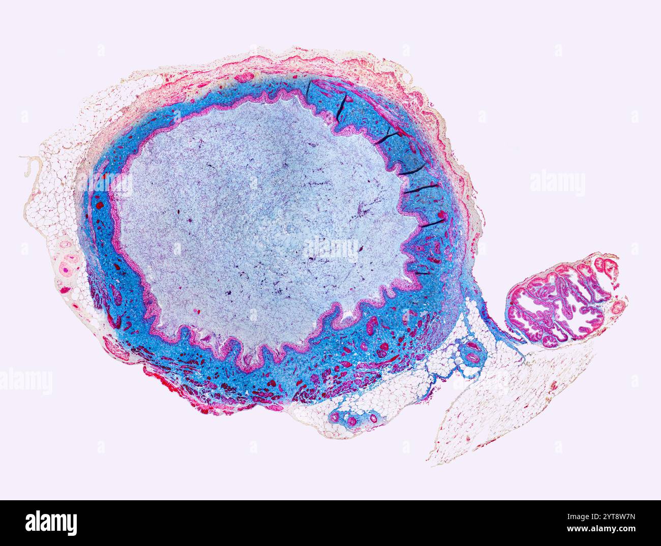 Micrograph showing the urinary bladder from a rat Stock Photo - Alamy