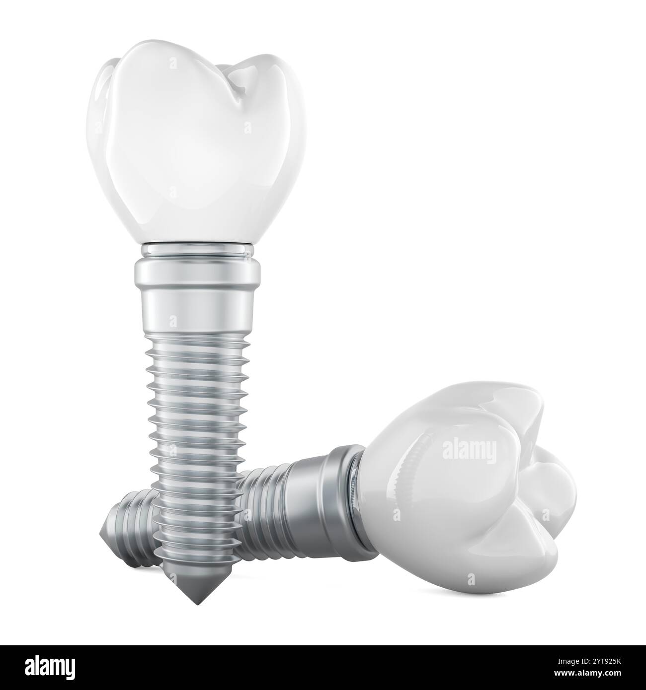 Two Dental implants. 3D rendering isolated on white background Stock ...
