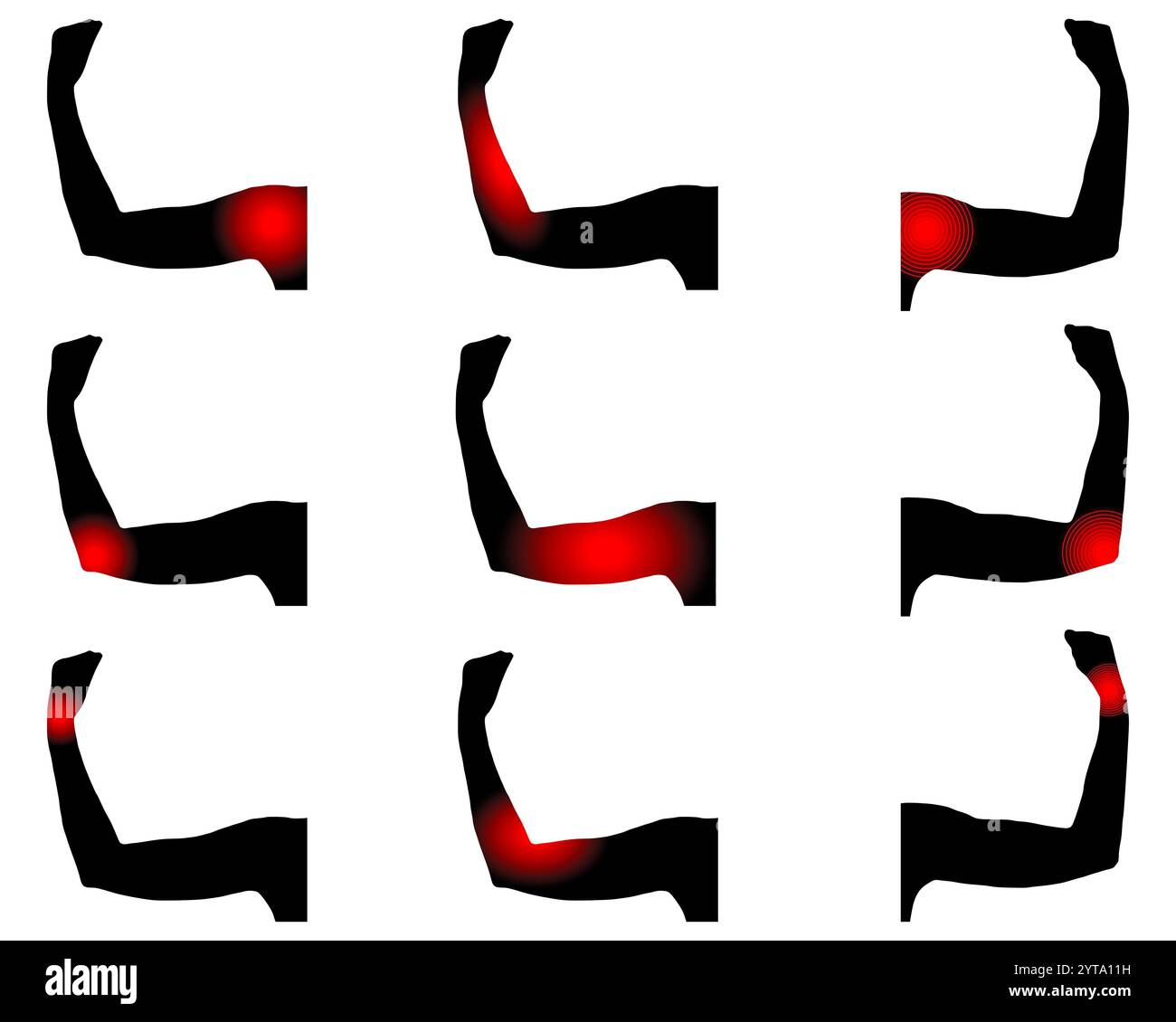 Arms with different pain points Stock Photo - Alamy