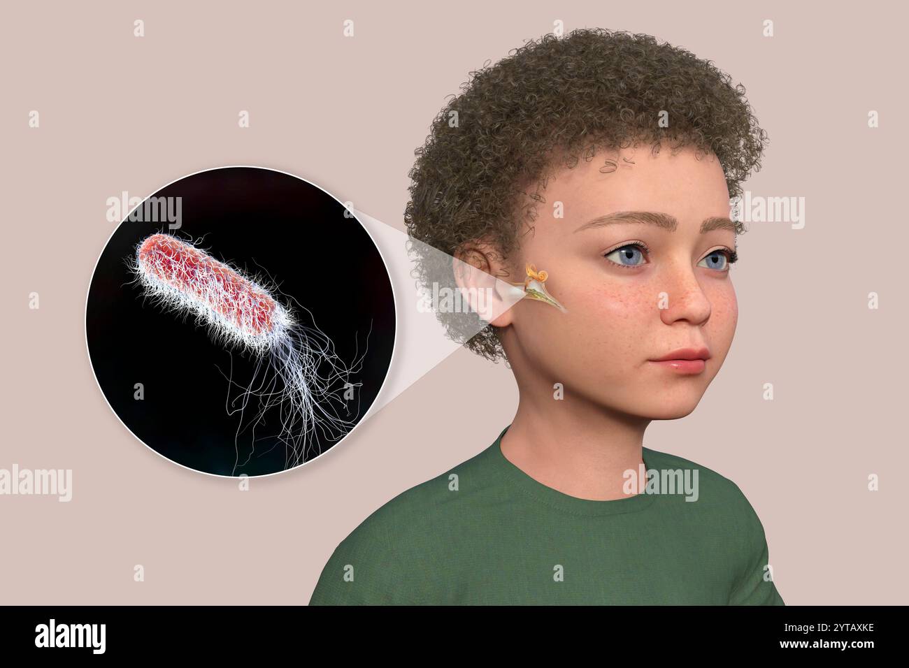 Computer illustration of a child with transparent skin revealing otitis ...
