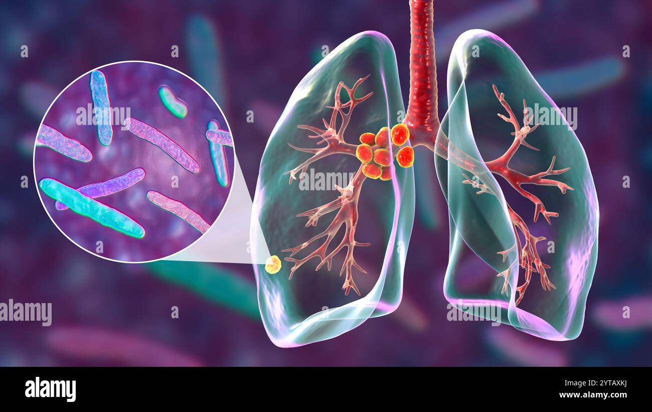 Ghon hi-res stock photography and images - Alamy