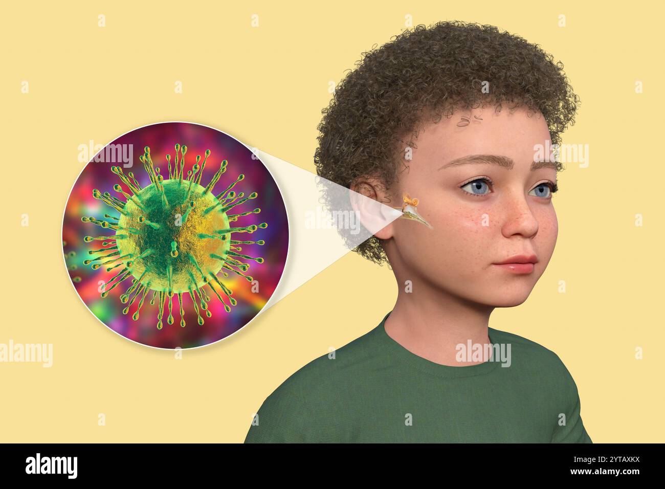Computer illustration of a child with transparent skin showing viral ...