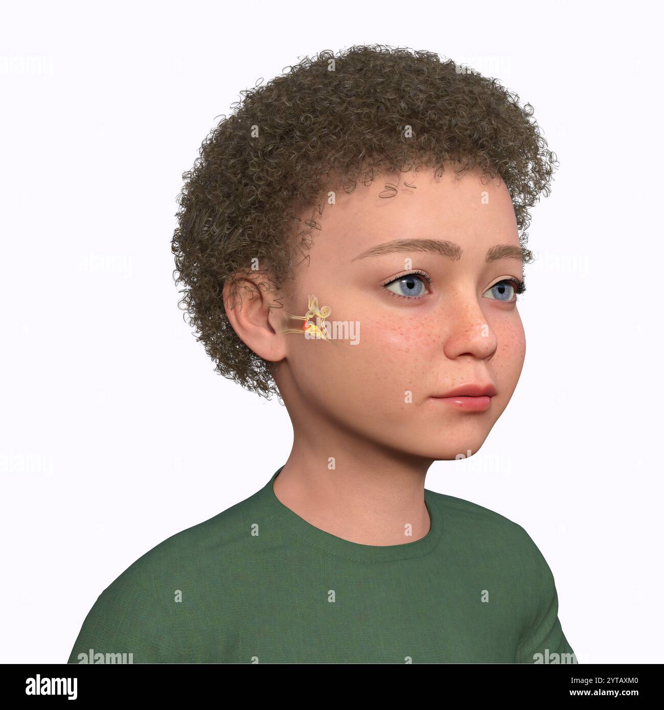 Otitis media in a child hi-res stock photography and images - Alamy