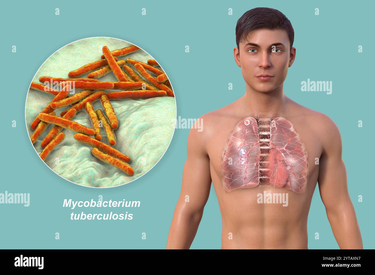 Computer illustration of a man with transparent skin revealing the ...