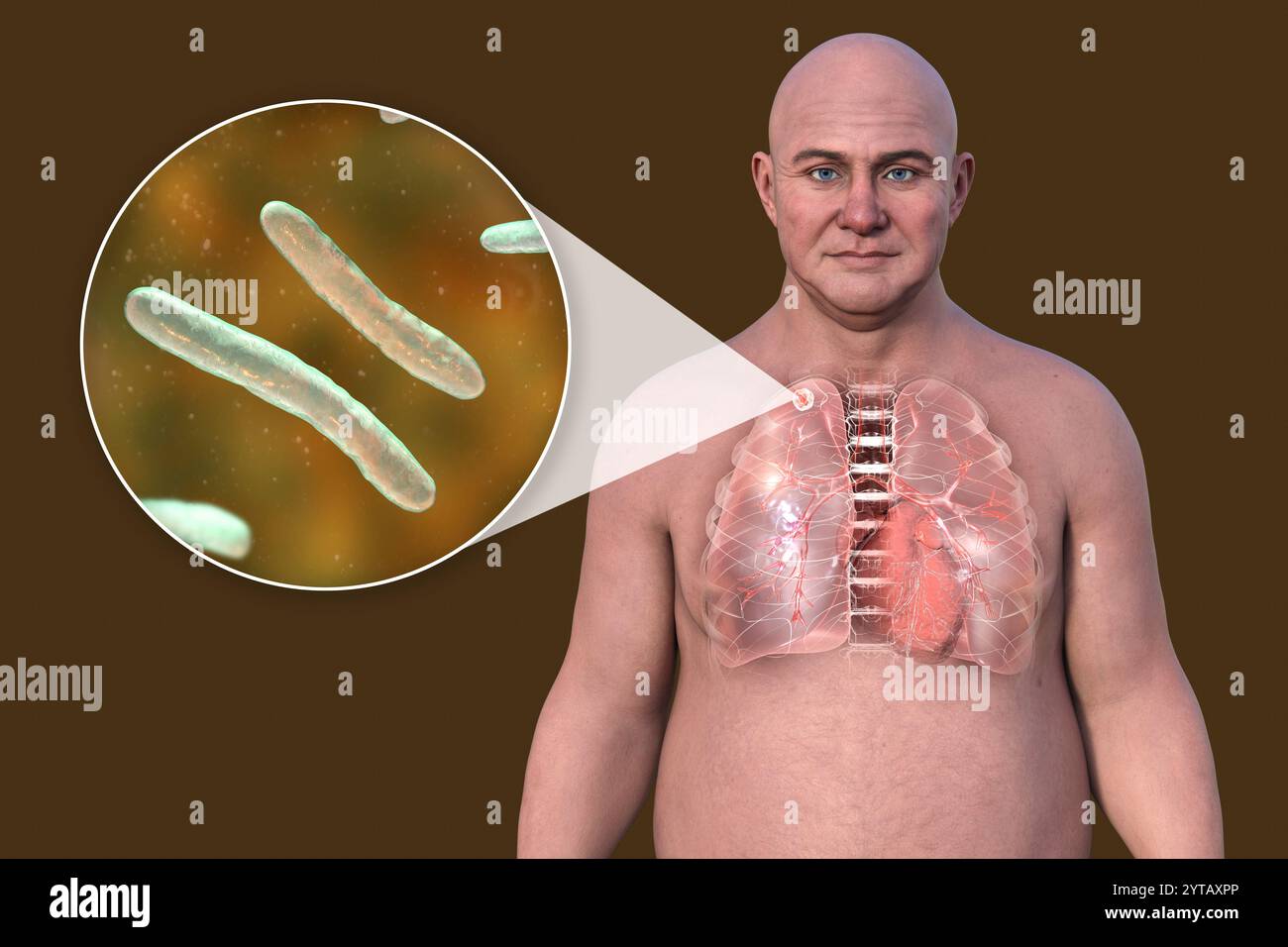 Computer illustration of a man with transparent skin revealing the ...