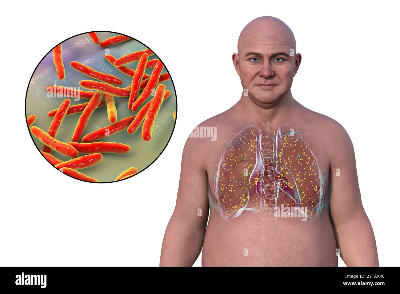 Computer illustration of a man with transparent skin, revealing the ...