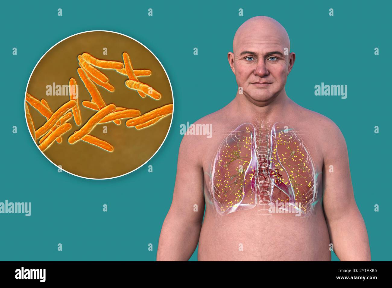 Computer illustration of a man with transparent skin, revealing the ...