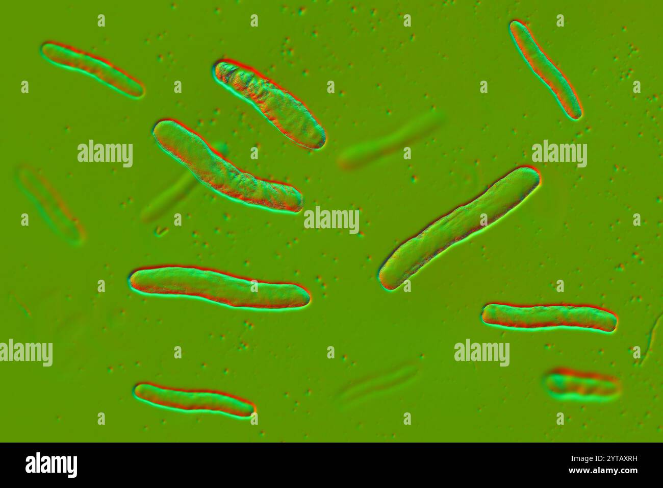 Computer illustration of Mycobacterium tuberculosis, the bacteria ...