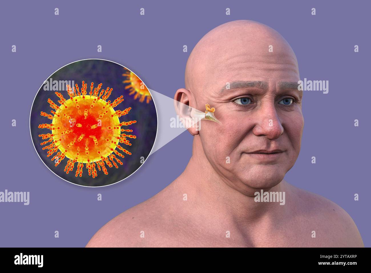 Computer illustration of a man with transparent skin showing viral ...