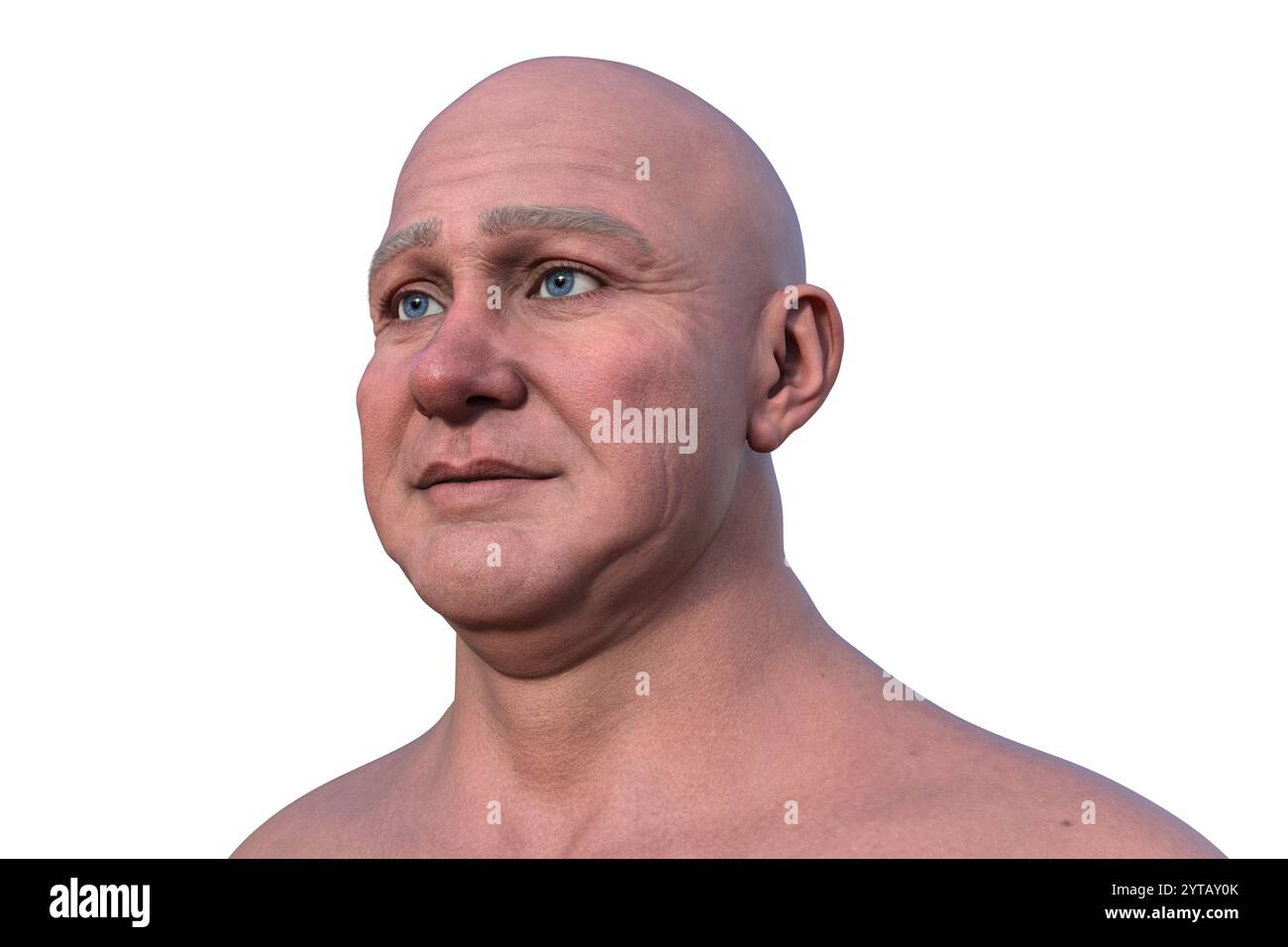 Computer illustration of a middle-aged bald man's face and neck Stock ...