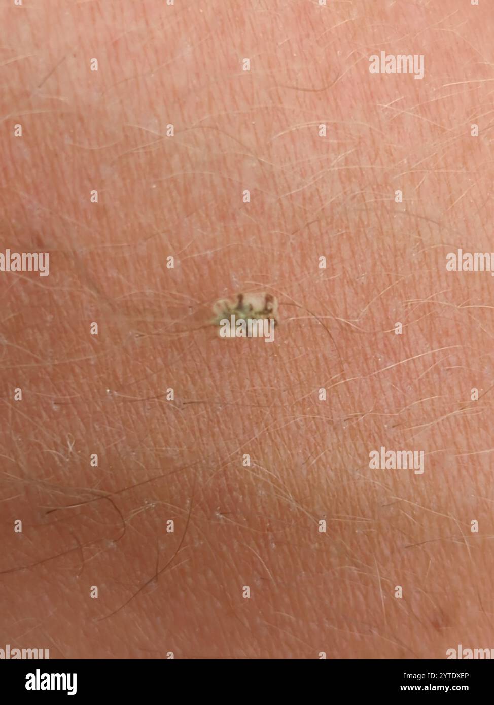 Eastern Sycamore Lace Bug (Corythucha ciliata Stock Photo - Alamy