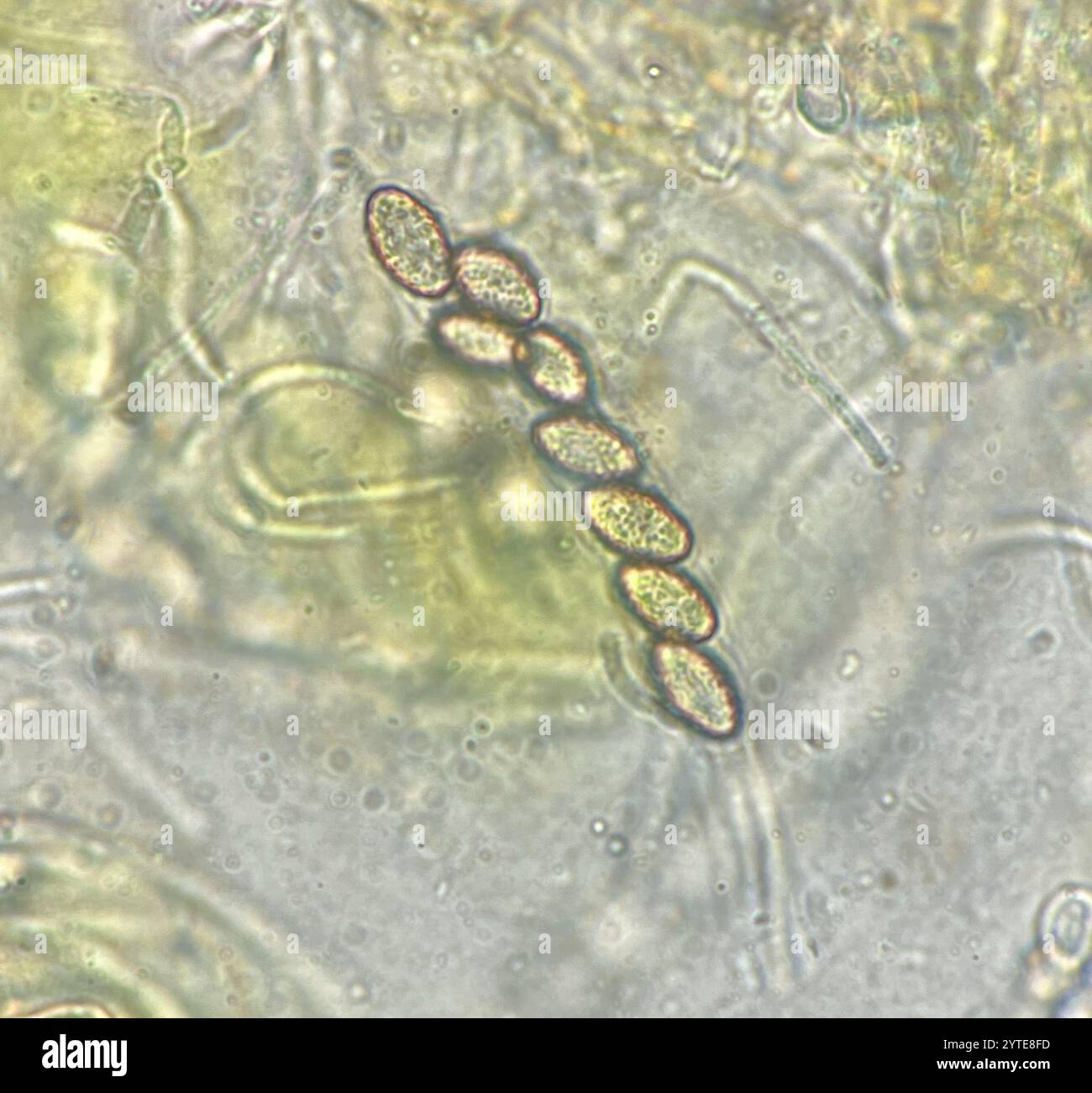Ascobolus hi-res stock photography and images - Alamy