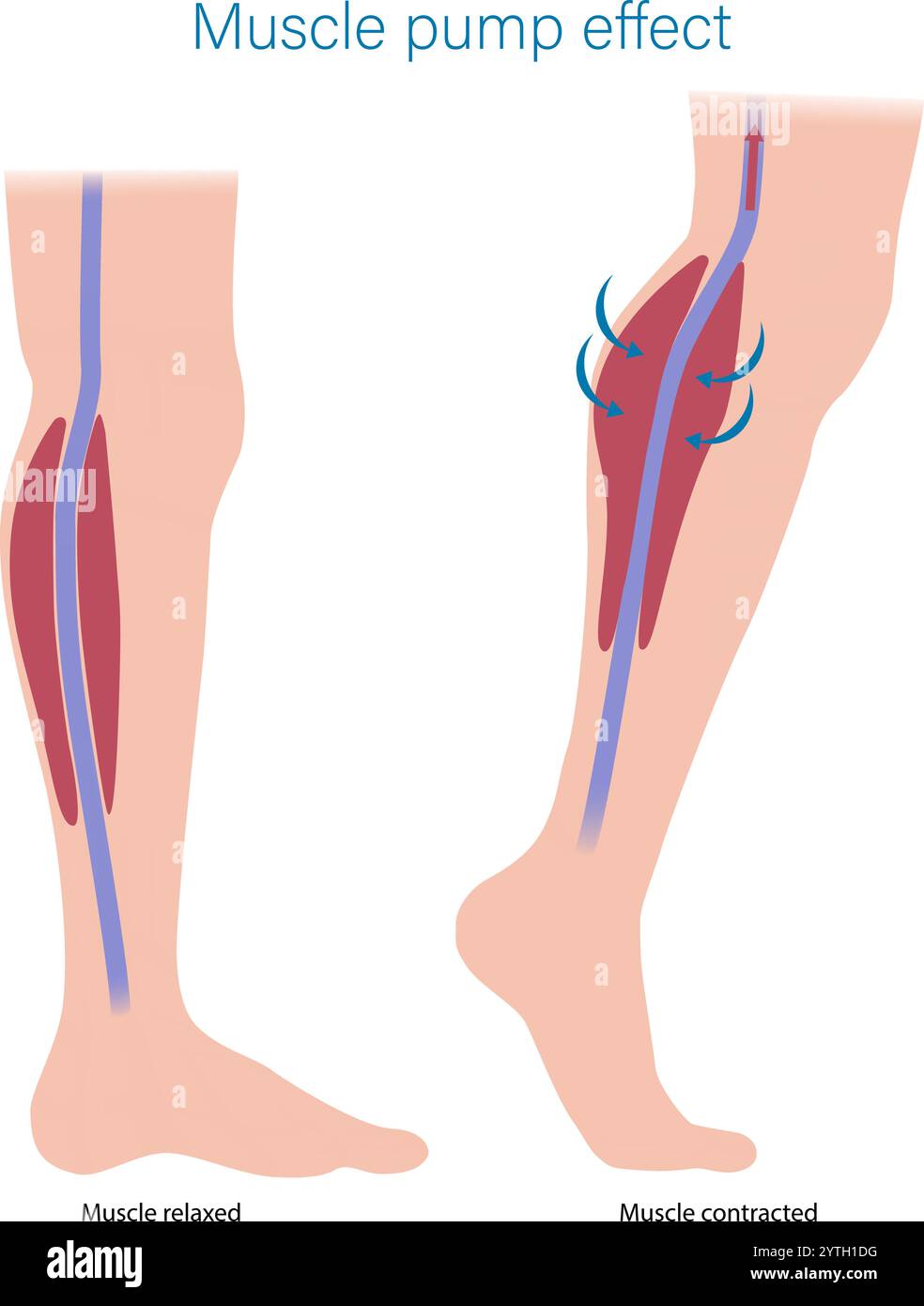 Skeletal Muscle pump effect. Illustration of muscle pump effect on ...