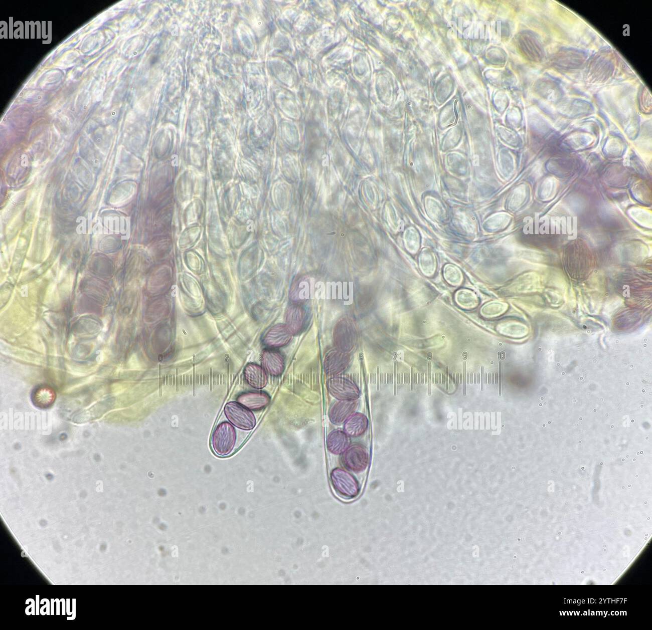 Ascobolus hi-res stock photography and images - Alamy