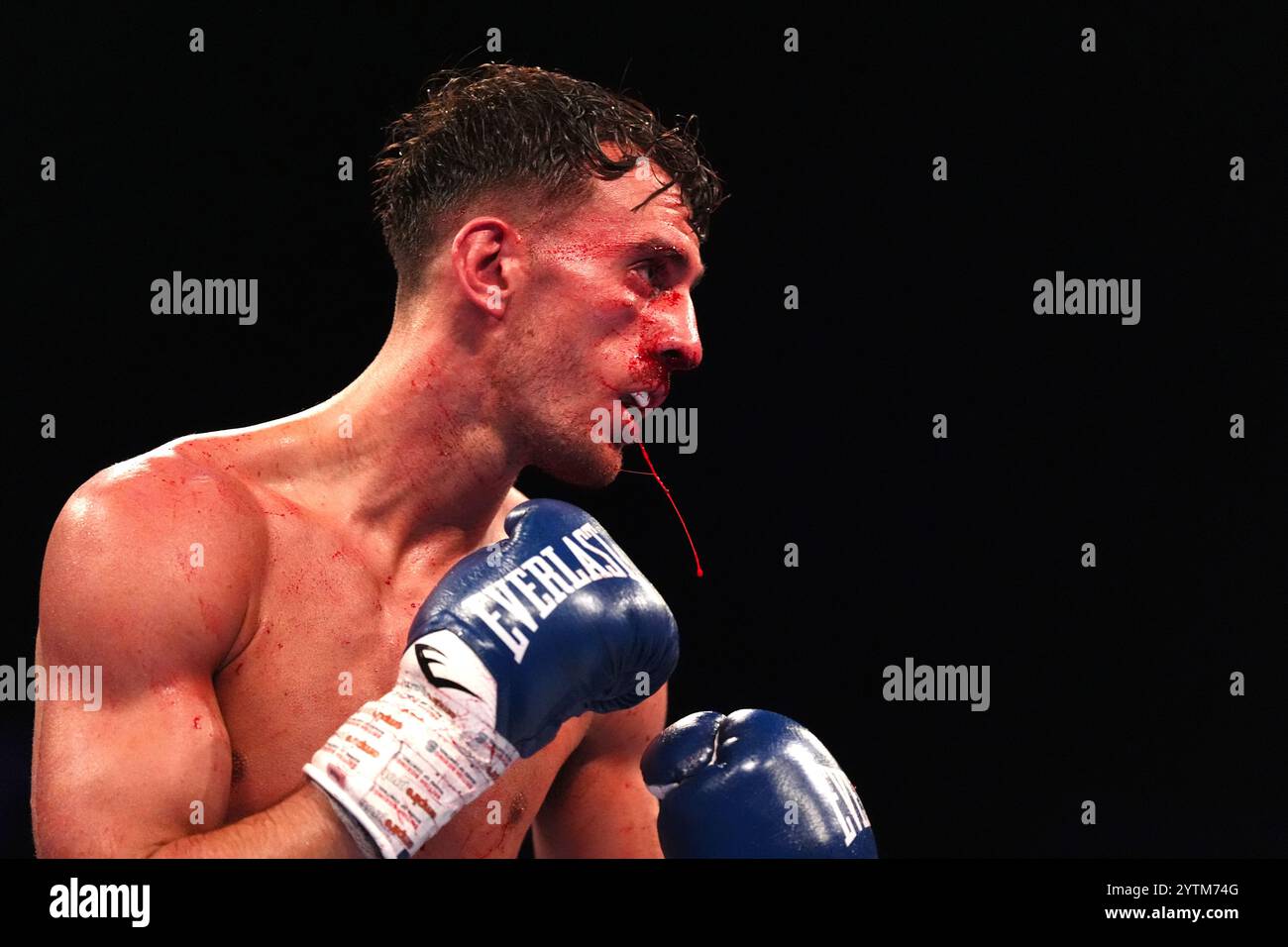 Mathew Rennie against Sean Noakes (not pictured) at the OVO Arena ...