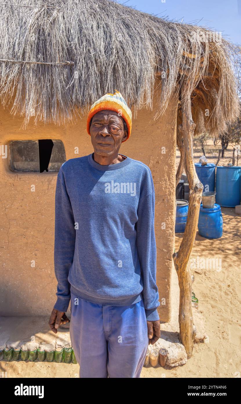 village old african man with big bulged eye , deformed face, medical ...