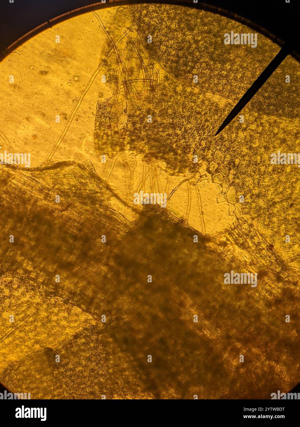 Square-leaved Crestwort (Chiloscyphus polyanthos Stock Photo - Alamy