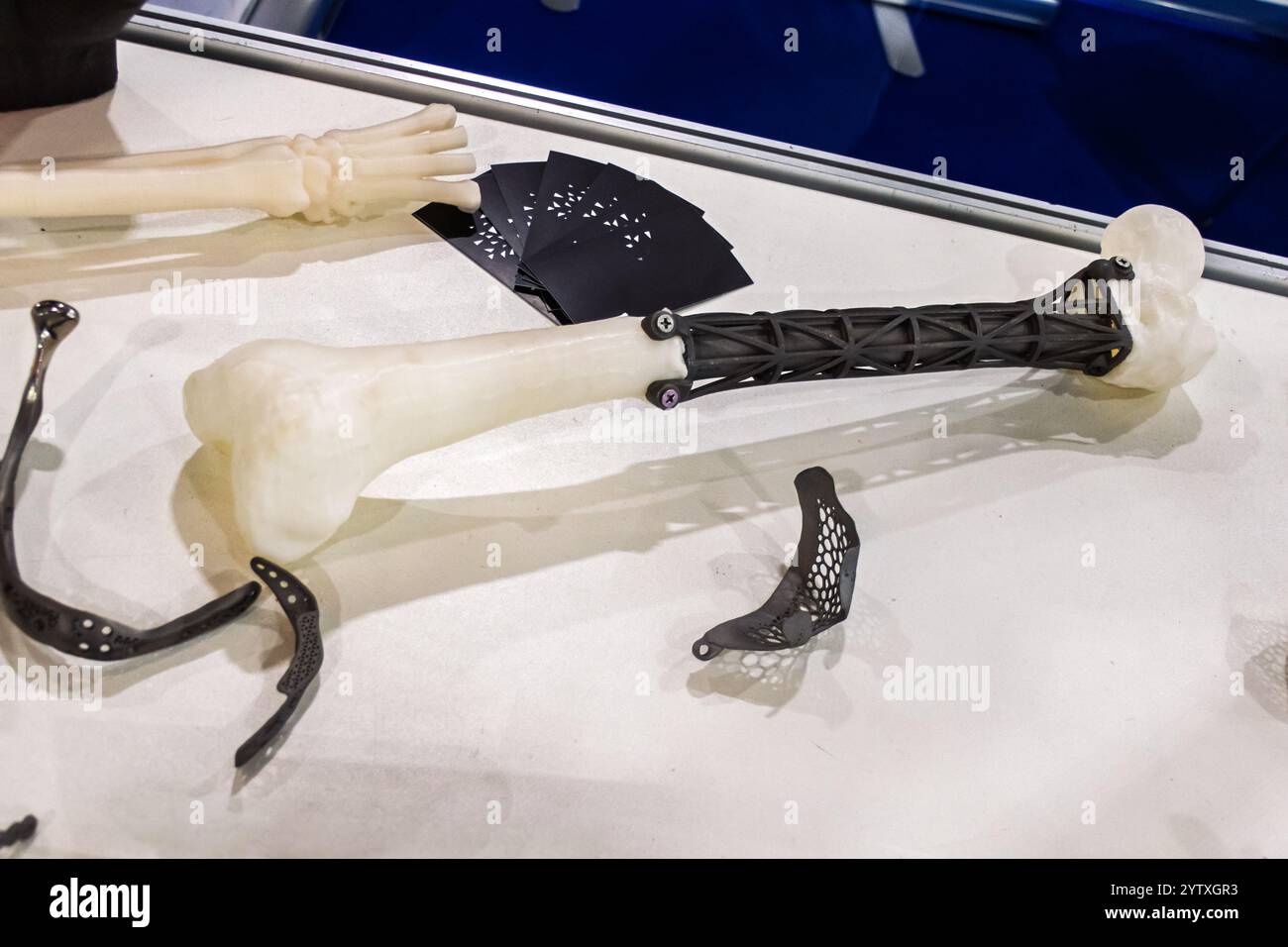 Orthopedic implants and individual titanium cranioplasties printed on a ...