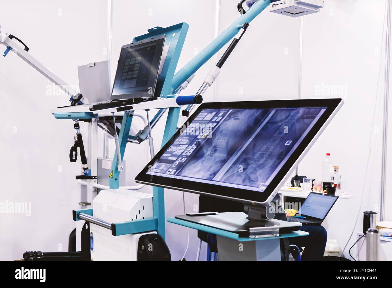 X ray images displayed hi-res stock photography and images - Alamy