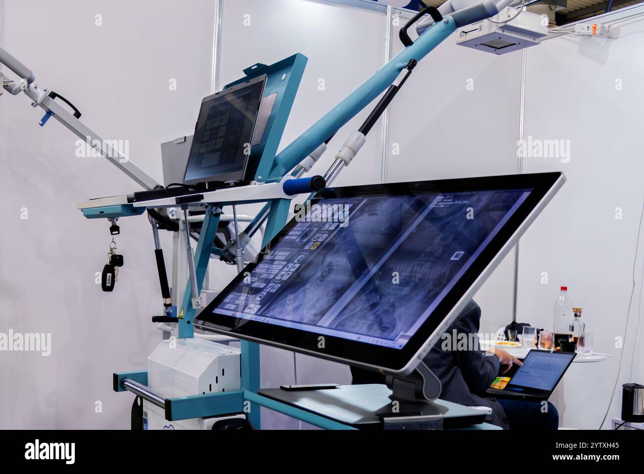 Modern portable X-ray machine with images displayed on a monitor Stock ...