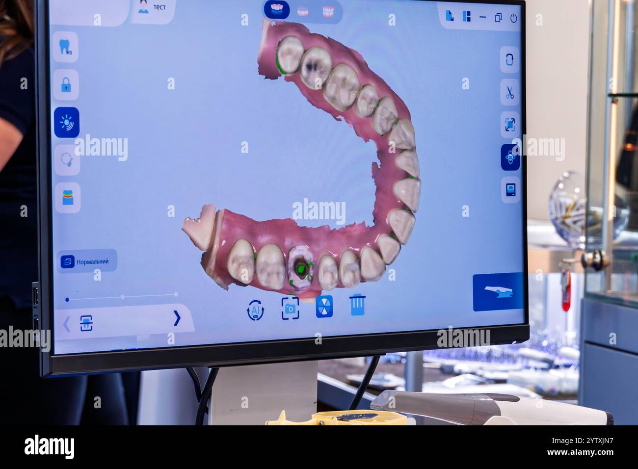 3D jaw on the monitor of a dentist scanner Stock Photo - Alamy
