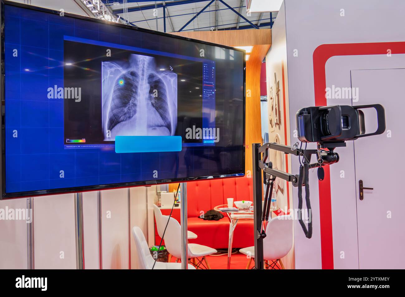 Displaying the results of ultrasound diagnostics on a large monitor ...