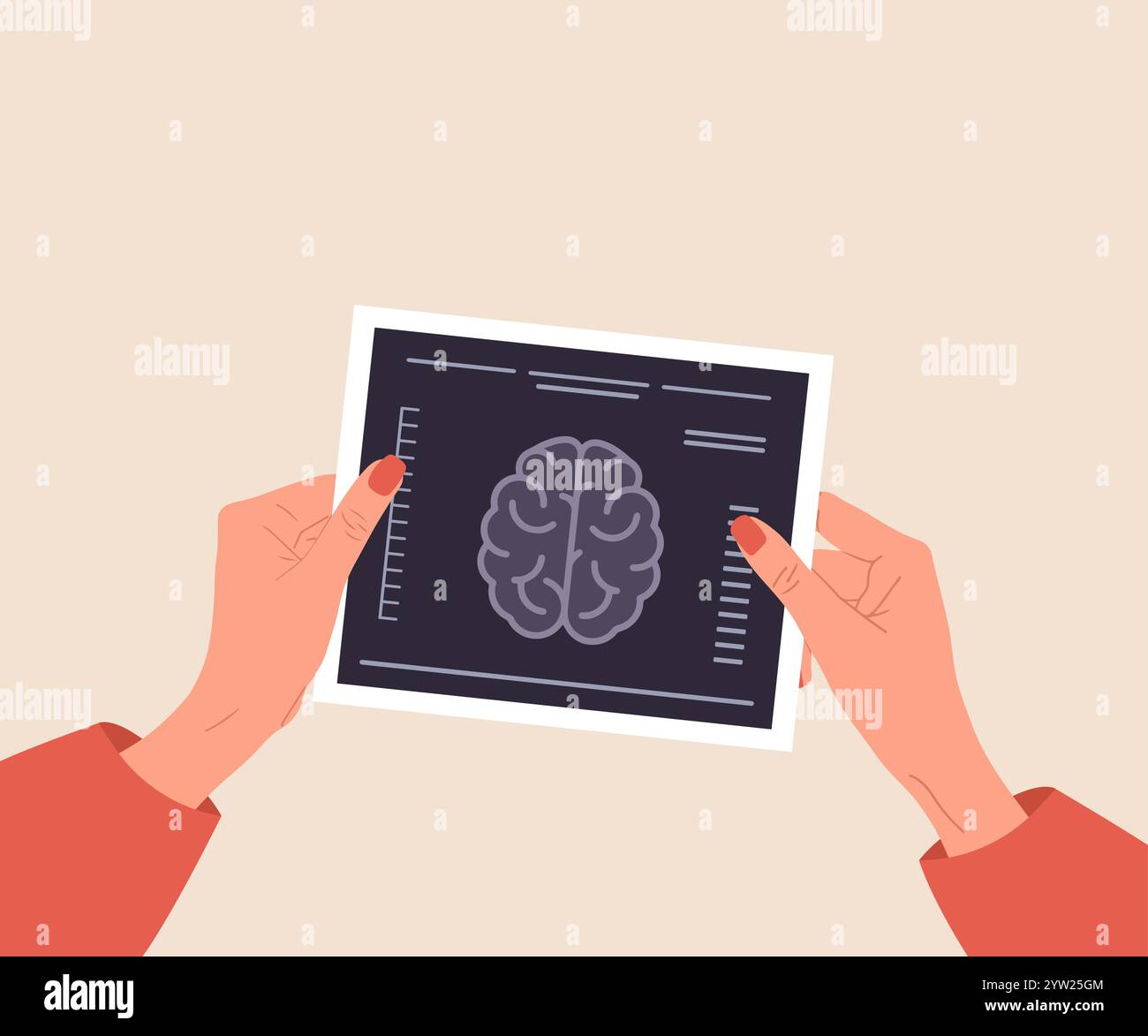 Neurologist concept. Female hand holding result of brain research ...