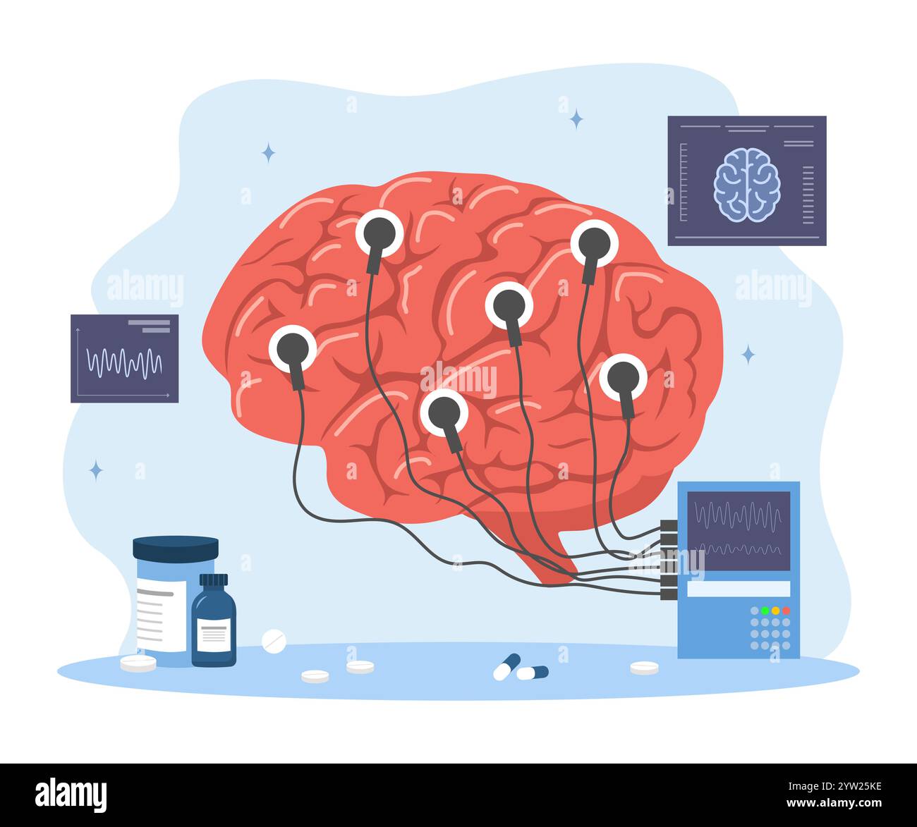 Epilepsy concept. Treatment nervous system. Electroencephalography ...