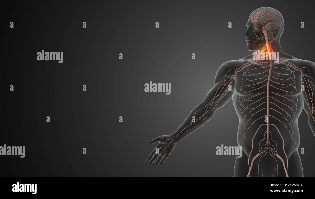 Cervical radiculopathy hi-res stock photography and images - Alamy