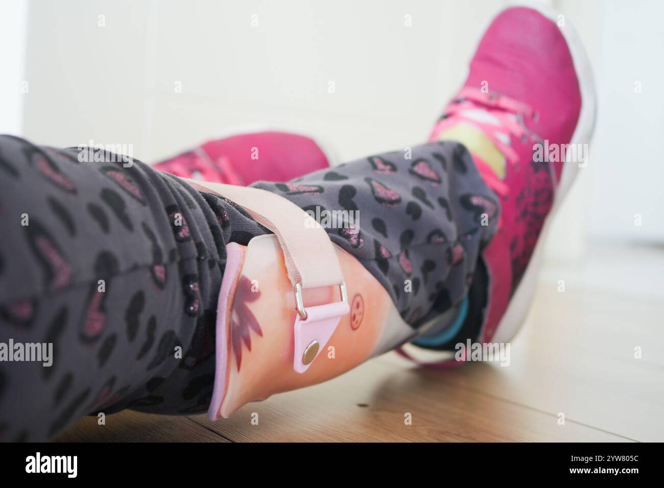 Close-Up of Child's Leg with Orthopedic Brace and Pink Sneakers Stock Photo - Alamy