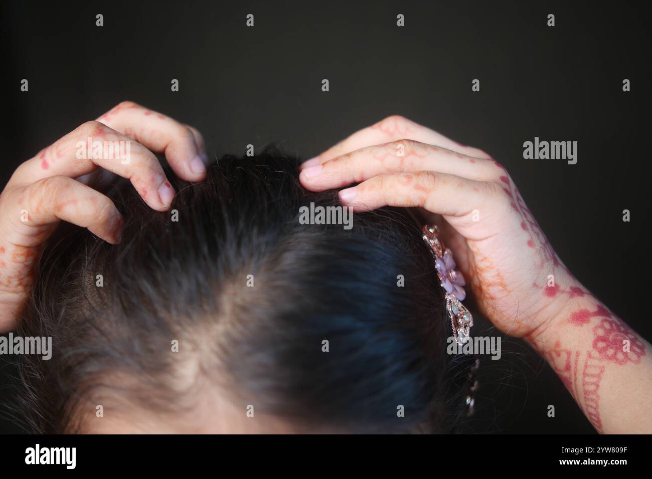 child Scratching her Head closeup Stock Photo - Alamy