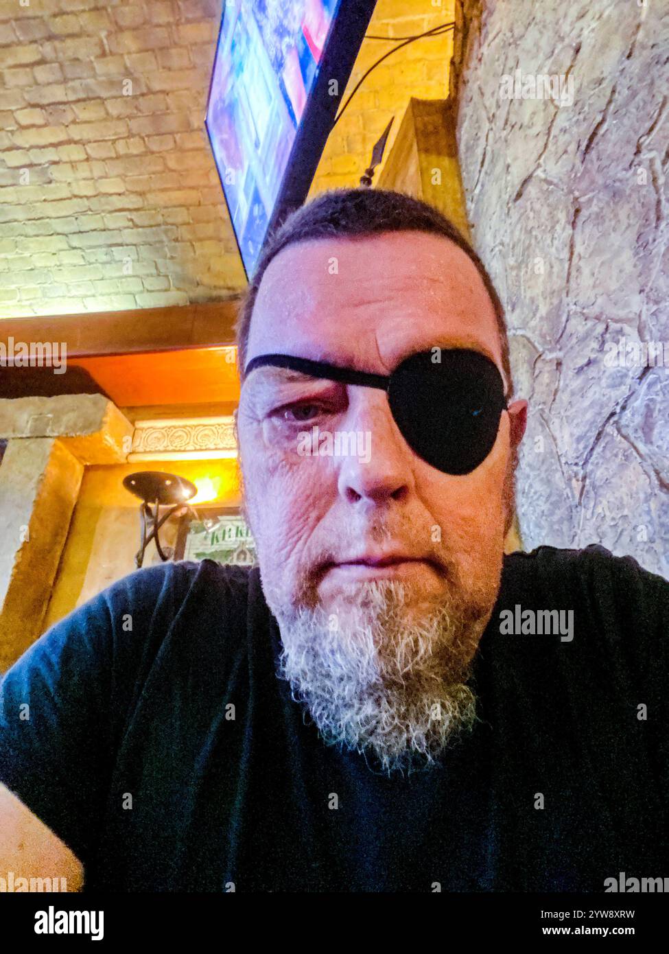 Self Portrait One Eye Berlin, Germany. Self Portait with One Eye Pirate ...