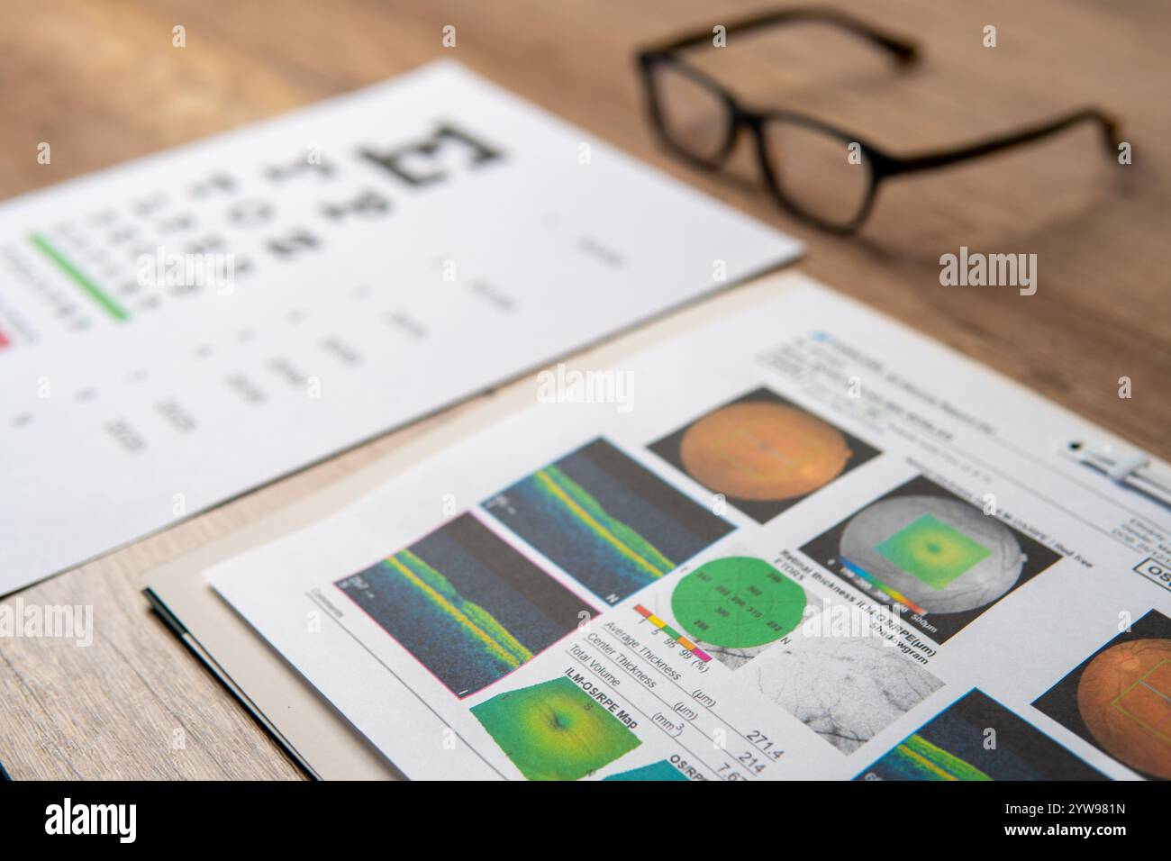 Eye vision test charts hi-res stock photography and images - Alamy