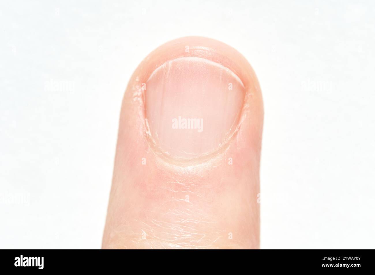 Close up view of a human fingernail on a caucasian adult finger Stock ...